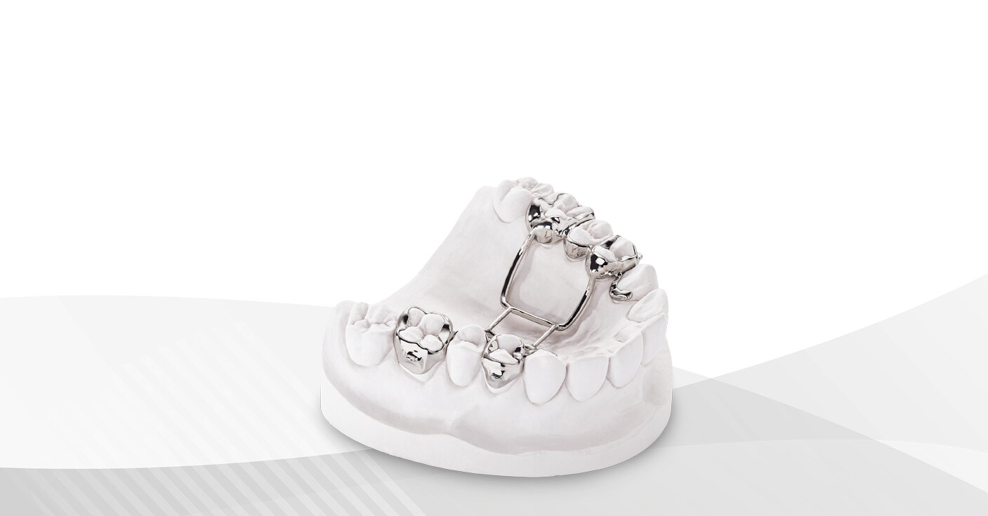 Digital orthodontics with CADdent