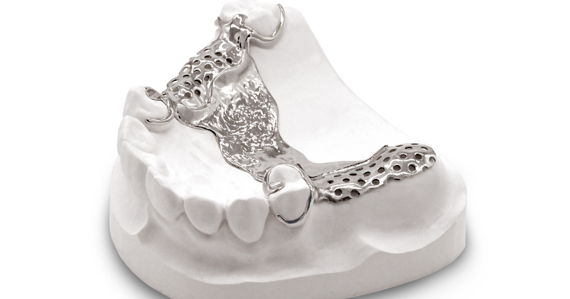 Châssis numériques: la qualité au plus haut niveau | CADdent®