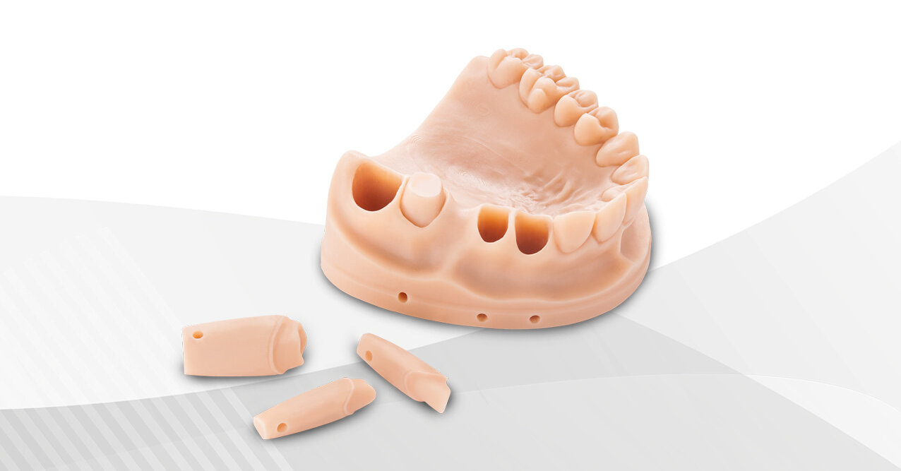 Modellherstellung im Dentallabor | CADdent GmbH